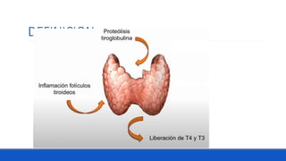 tiroiditis, revision de enfermedades tiroideas | PPTX