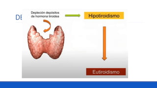 tiroiditis, revision de enfermedades tiroideas | PPTX