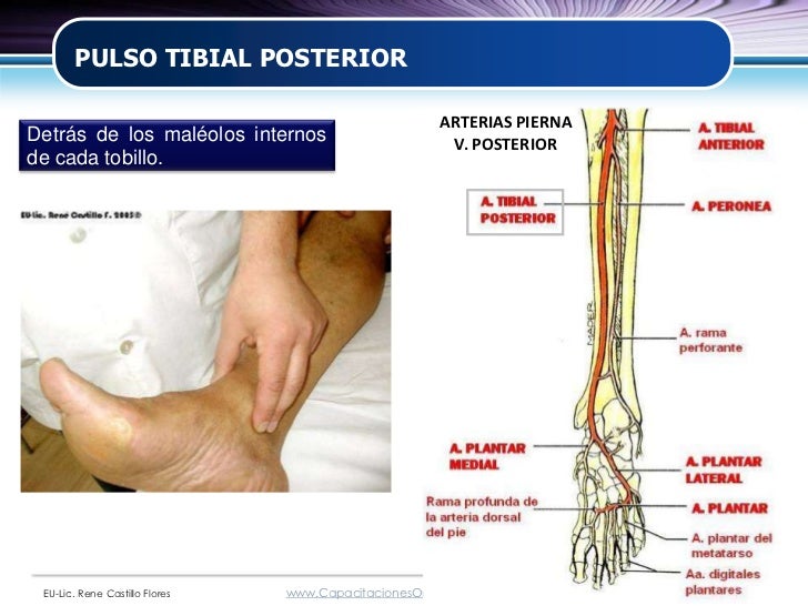 Pulso Tibial Posterior
