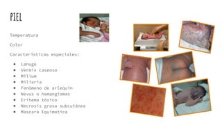 examen clinico del recién nacido .ppt neonatologia | PPTX