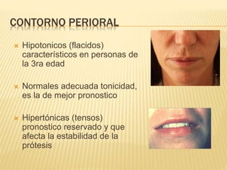 Examen clínico para pacientes desdentados | PPTX
