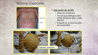 EXAMEN DE ABDOMEN.pptx como realizar la semiología | PPTX