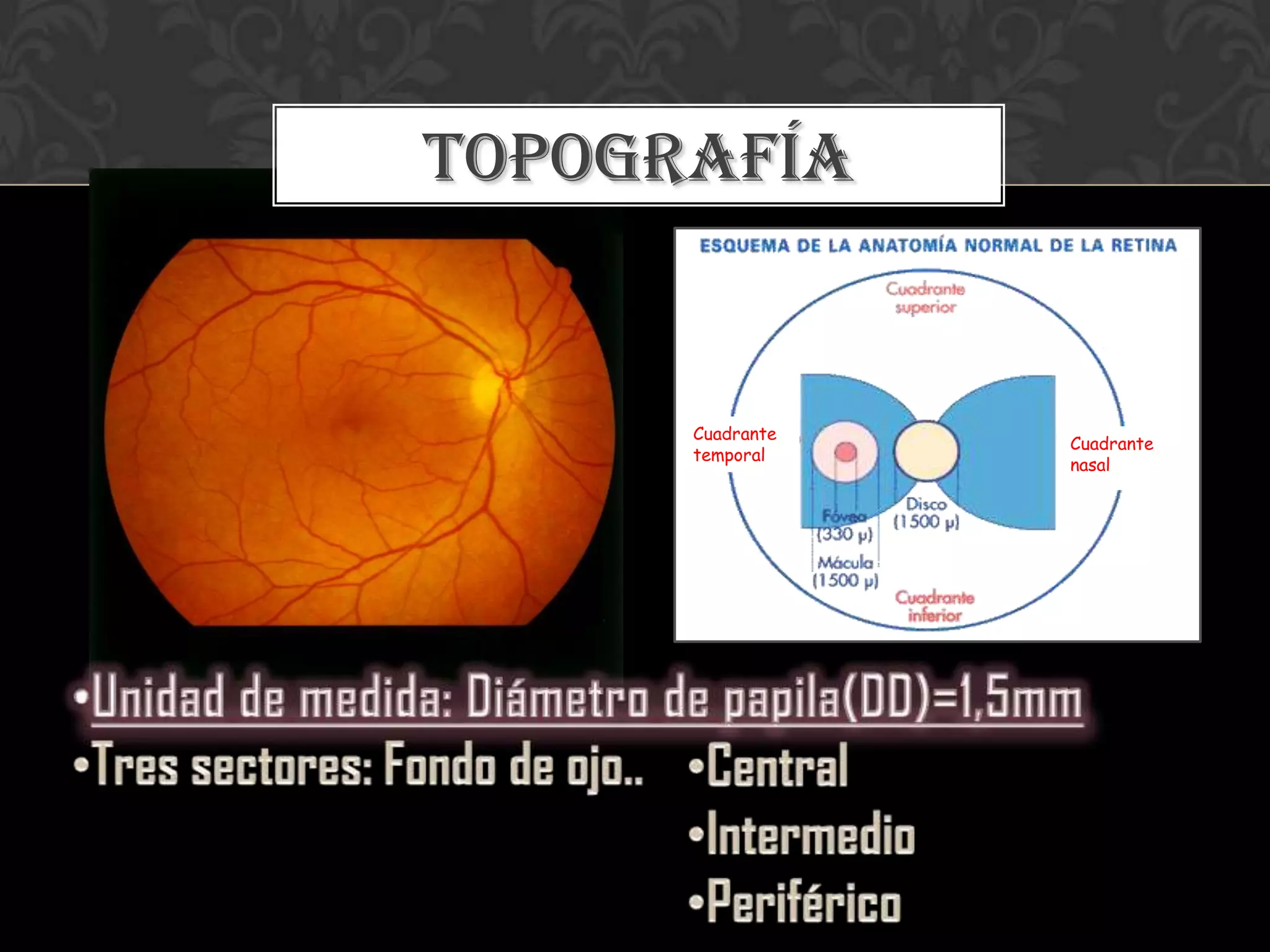 Examen de fondo de ojo