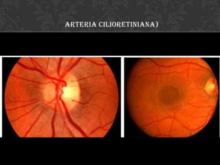 Examen de fondo de ojo | PPTX