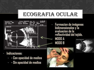Examen de fondo de ojo | PPTX