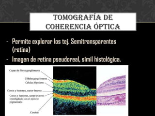 Examen de fondo de ojo | PPTX