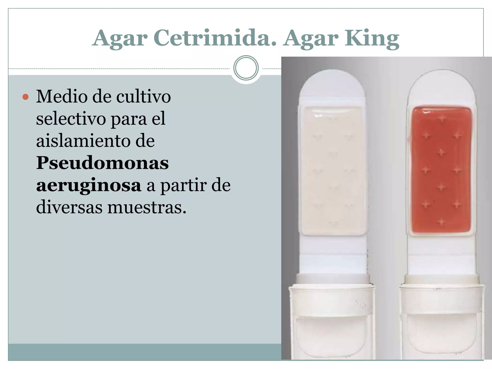 Examen del esputo parte ii | PPTX