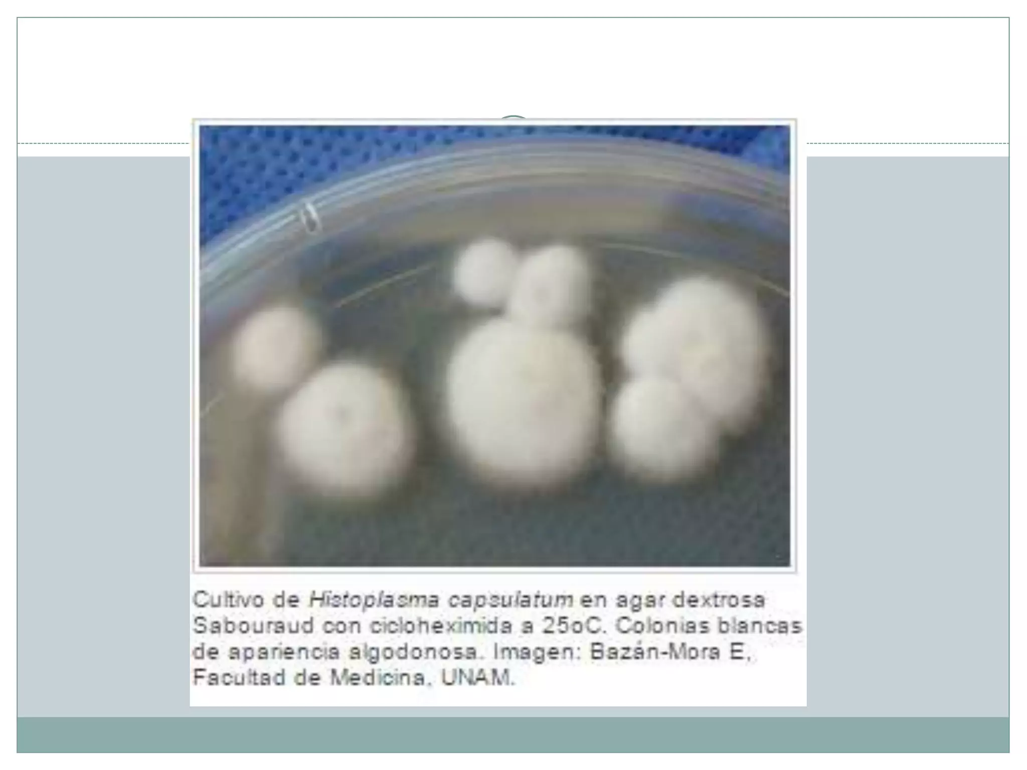 Examen del esputo parte ii | PPTX