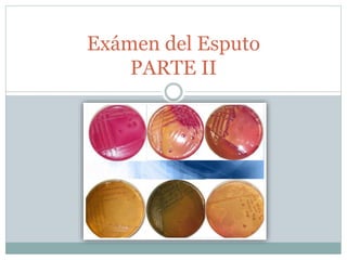 Examen del esputo parte ii | PPTX