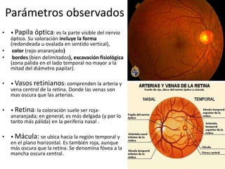 Examen del fondo de ojo | PPT
