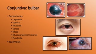 Examen del segmento anterior | PPTX