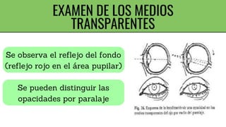 Examen del segmento ocular posterior. pdf | PDF
