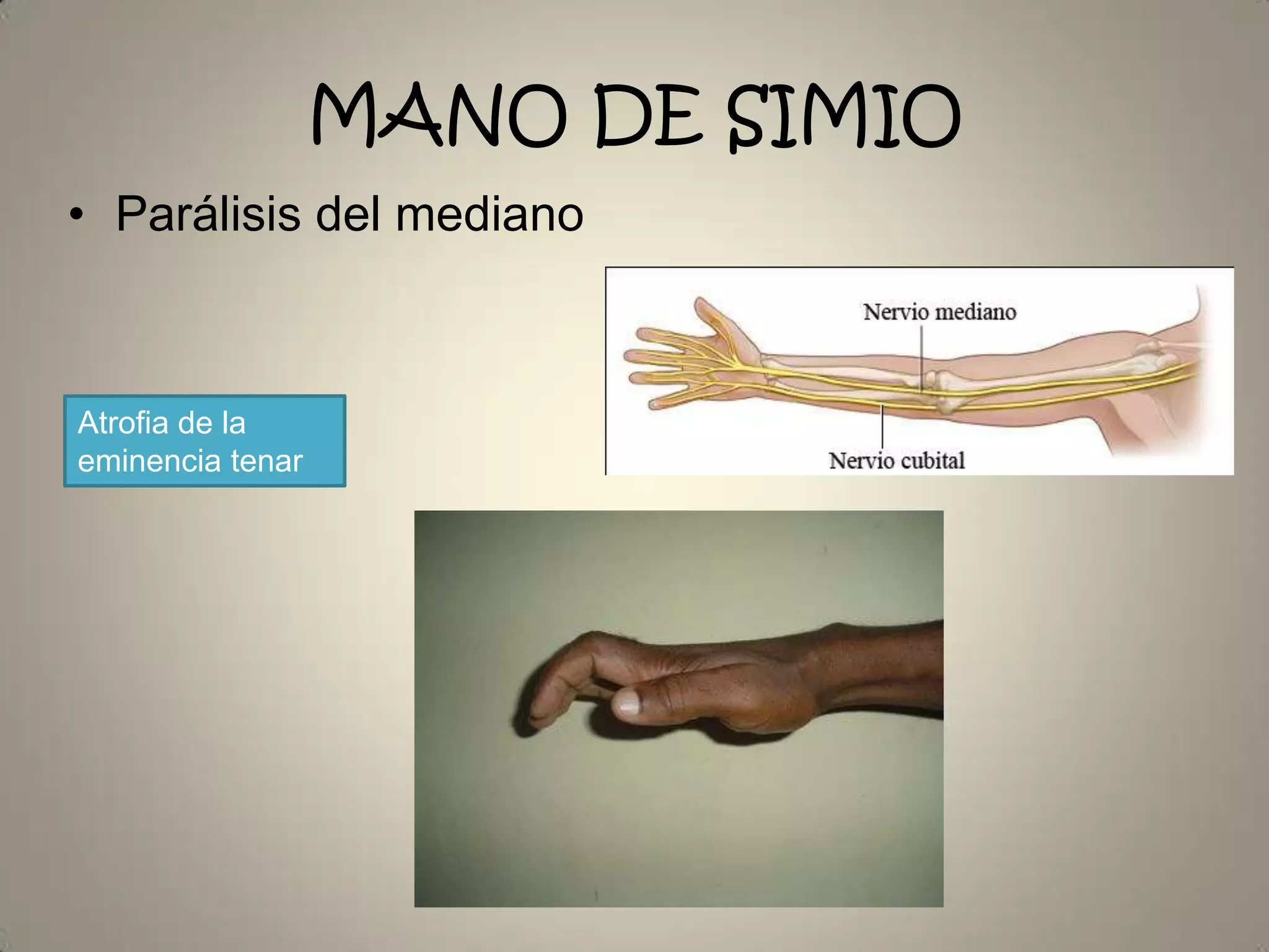 Examen del sistema nervioso | PPTX