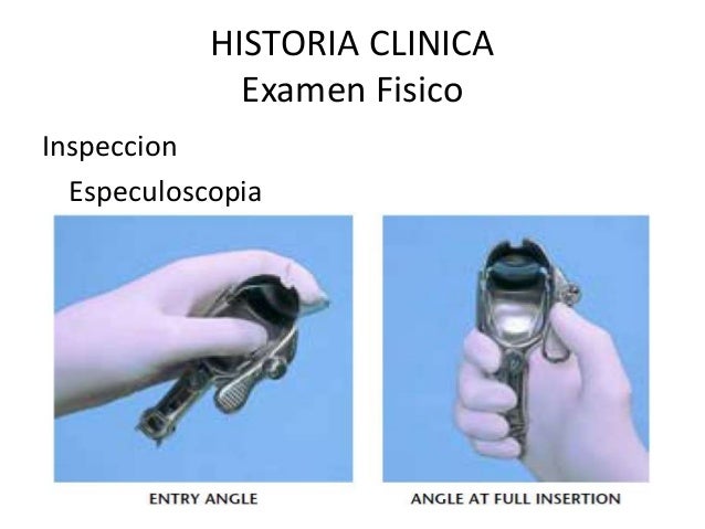 Examen del sistema reproductor femenino