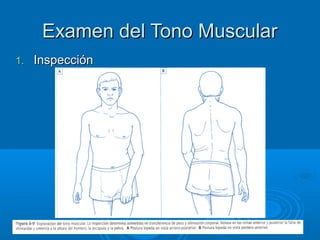 Examen del tono muscular | PPT
