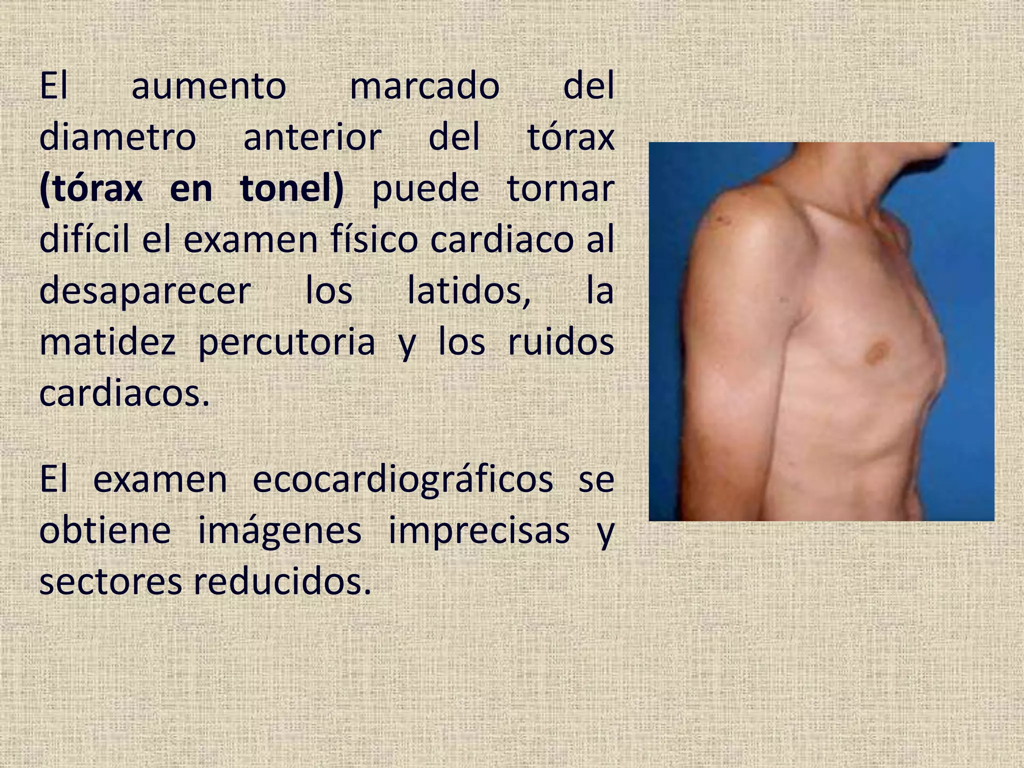 Examen de torax | PPT