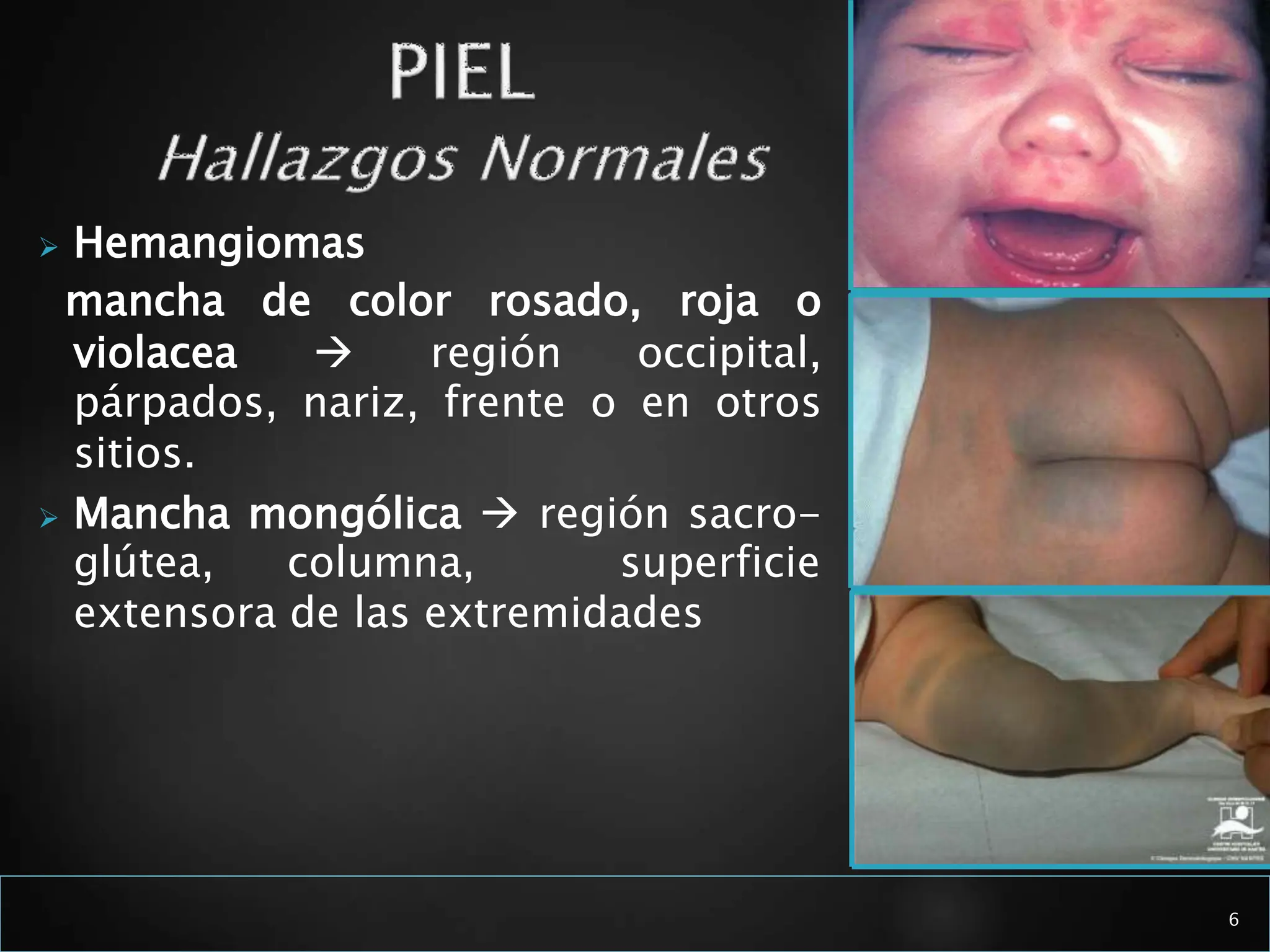 EXAMEN FISICO de recien nacido, y sus principales signos. | PPT