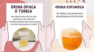 EXAMEN FISICO DE UN EXAMEN COMPLETO DE ORINA | PPTX