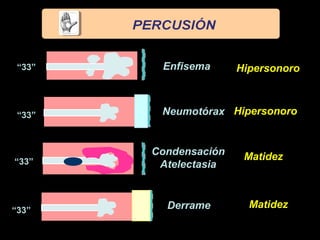 Examen fisico de torax 09 | PPT