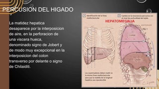 EXAMEN FISICO DE ABDOMEN semiologia de abdomen | PPTX
