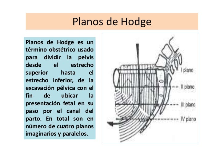 Planos De Hodge