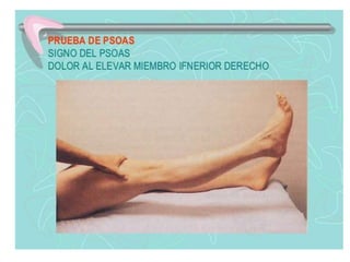 EXAMEN FISICODEL ABDOMEN.pptx