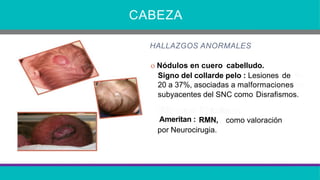 Examen físico cabeza y cuello | PPTX