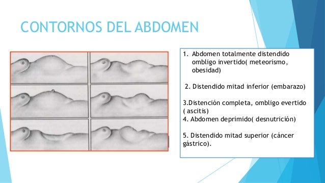 Examen físico de abdomen