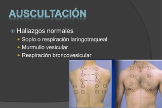 Examen físico del aparato respiratorio | PPTX