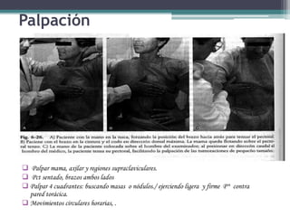 Examen físico de las mamas y las axilas | PPTX