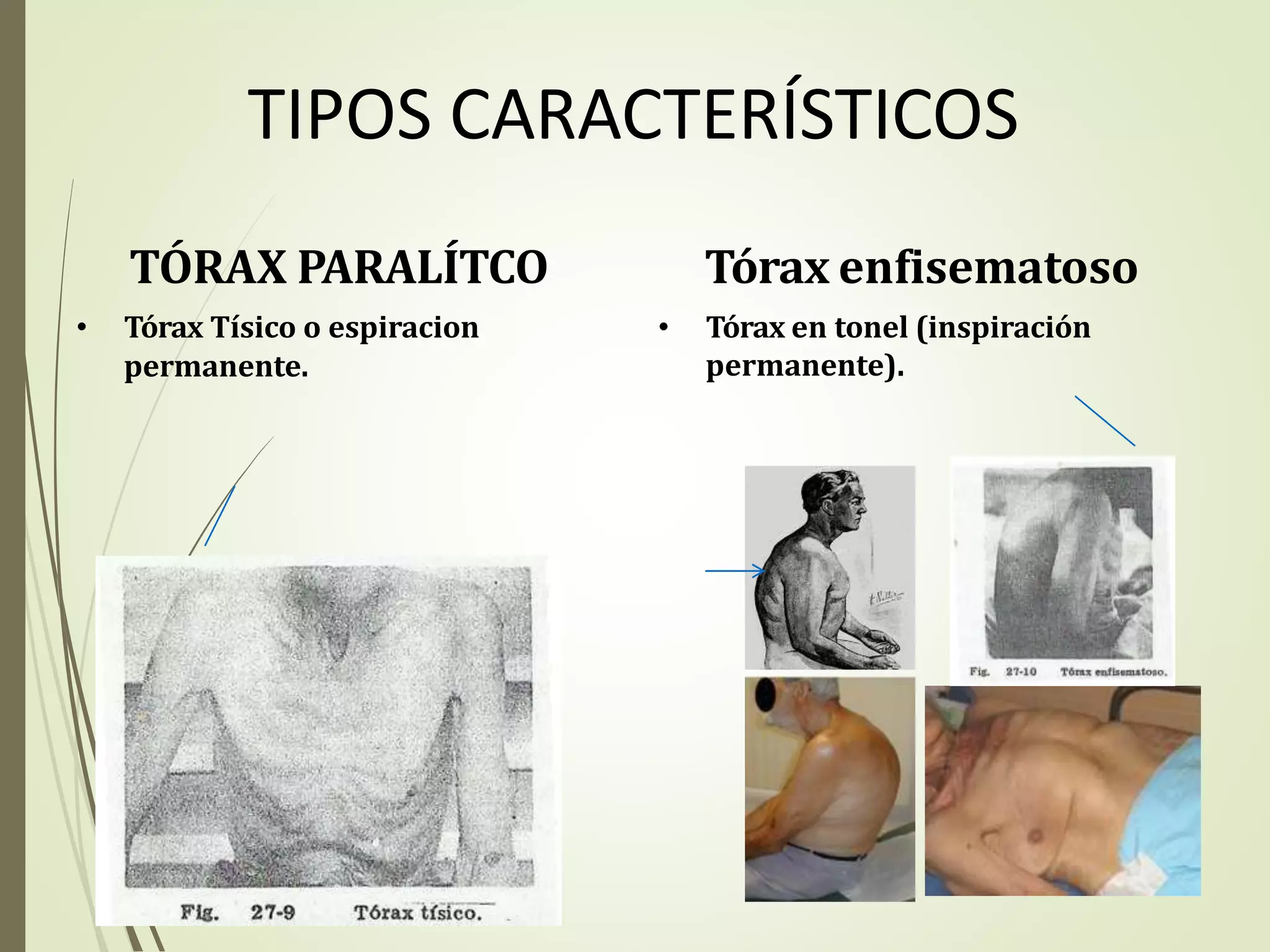 EXAMEN FÍSICO DE TORAX.pptx