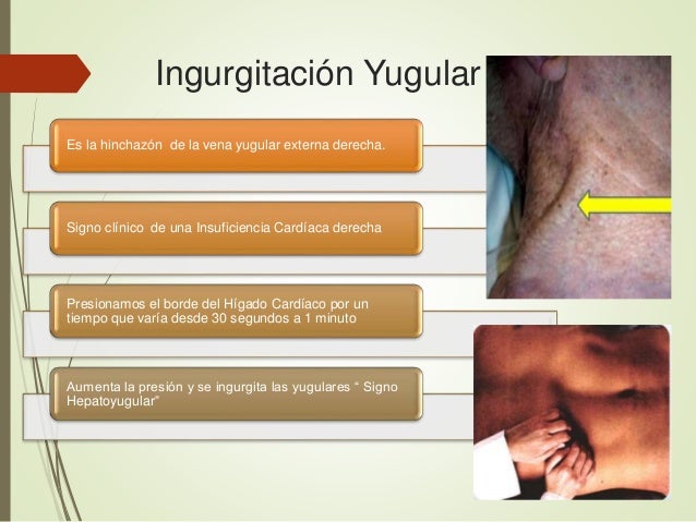 Examen físico de tórax y cuello