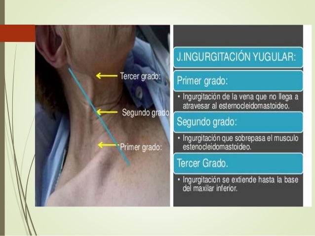 Examen físico de tórax y cuello