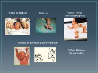 Examen fisico del RN | PPTX