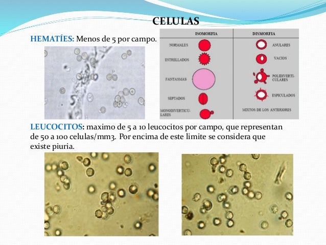 Examen general de orina