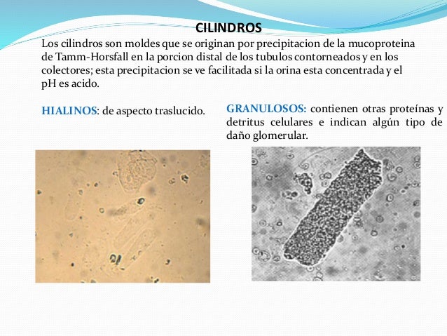 Examen general de orina