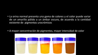 EXAMEN GENERAL DE ORINA.pptx