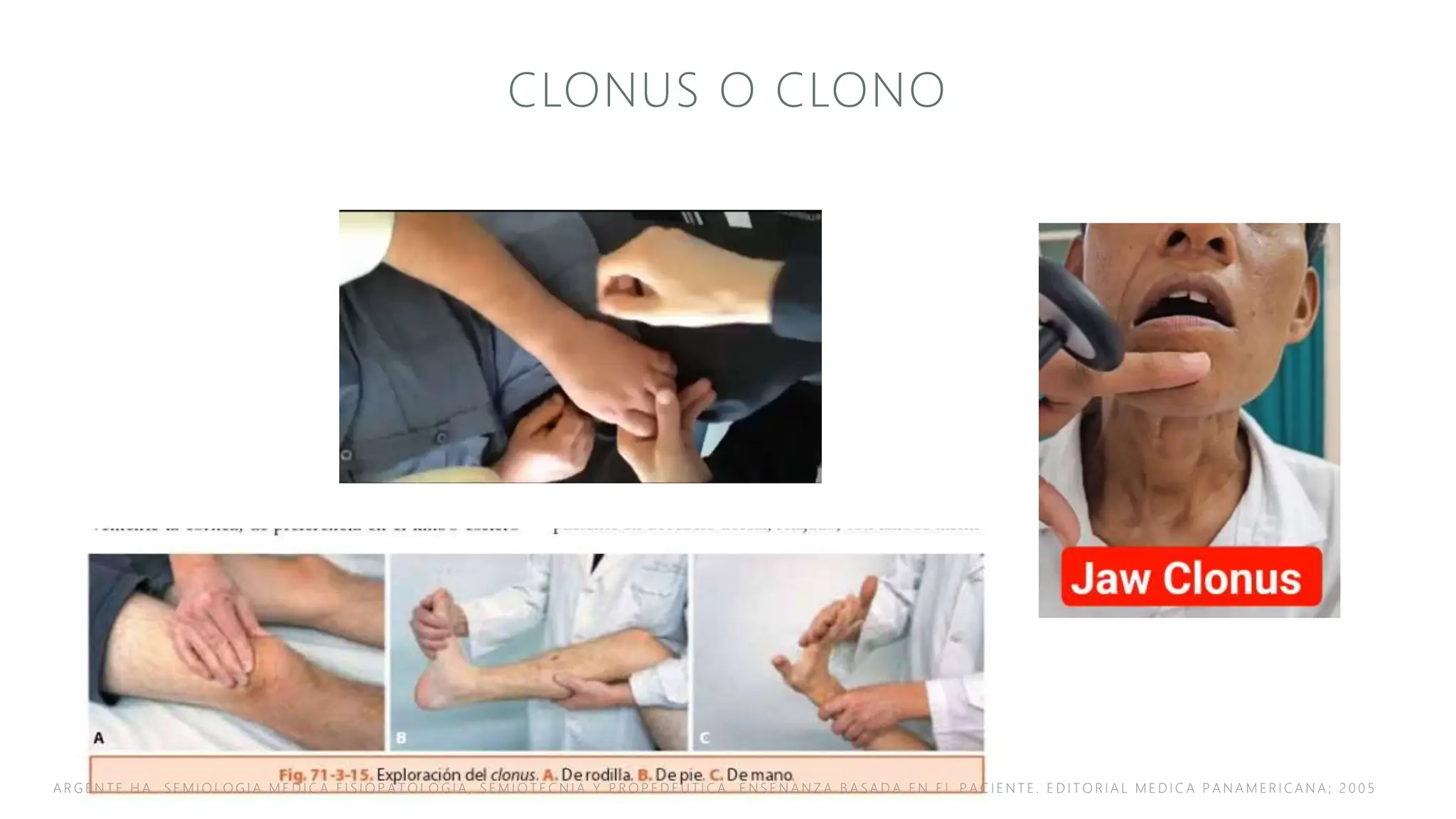 Examen neurológico y aparato locomotor (2da parte) sin terminar.pptx