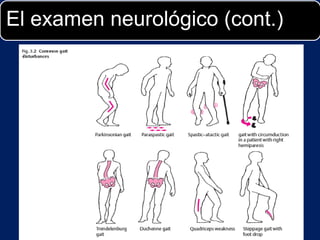 Examen neurologico Dr. Roma Juan Carlos. | PPT
