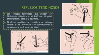 Examen neurológico del recién nacido | PPTX