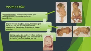 Examen neurológico del recién nacido | PPTX