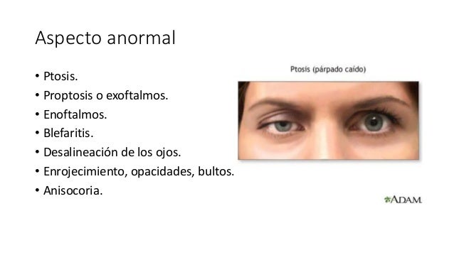 Examen oftalmológico del adulto