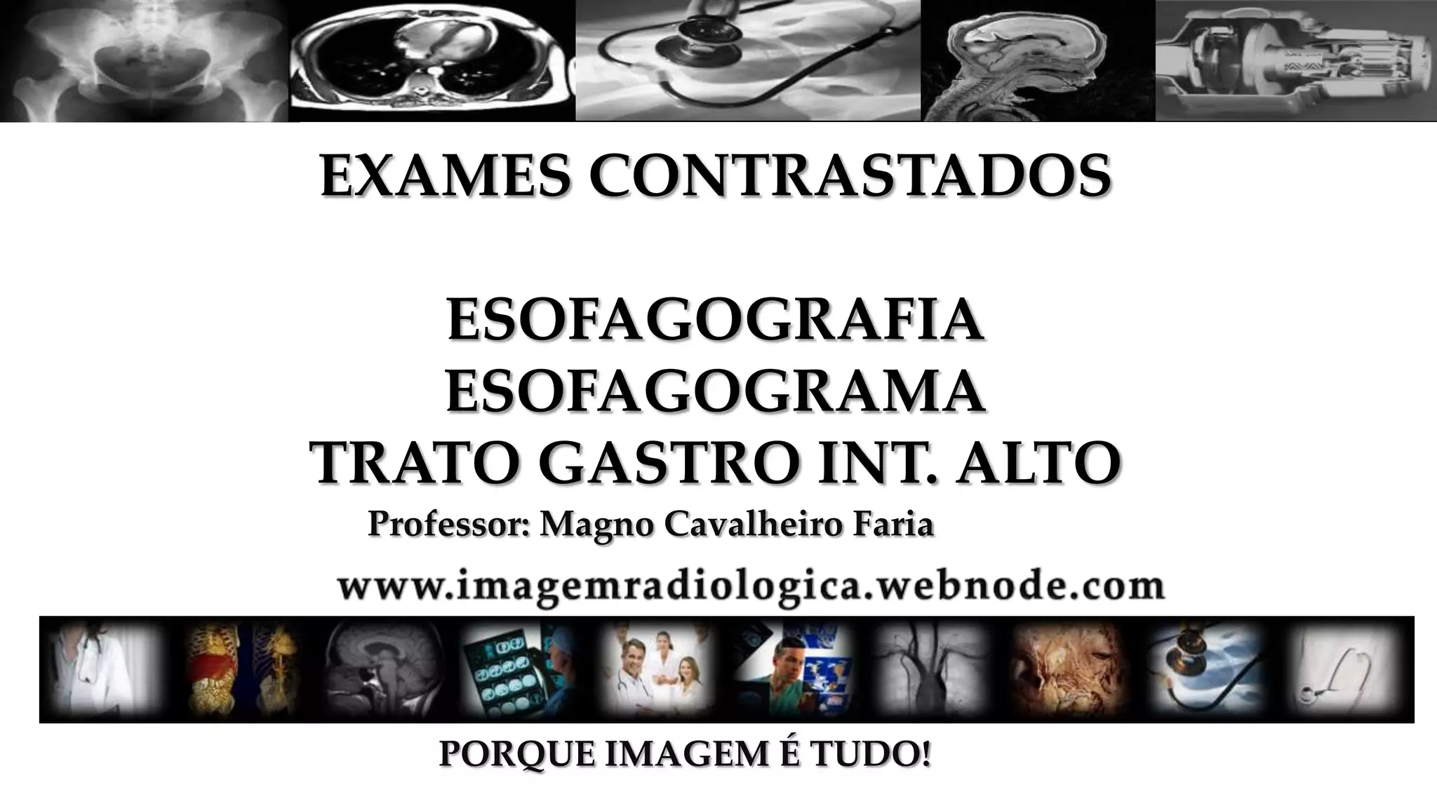 Exames contrastados esofagografia | PPT | Download Gratuito