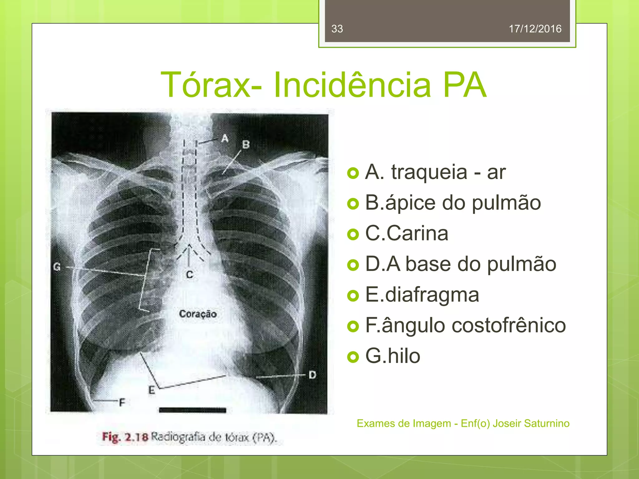 Avaliação de Exames de Imagem - Enfermagem | PPTX