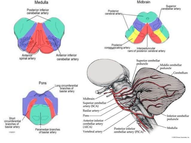 Examinarea CT cerebrala-AVC ischemic.pptx
