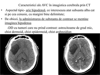 Examinarea CT cerebrala-AVC ischemic.pptx