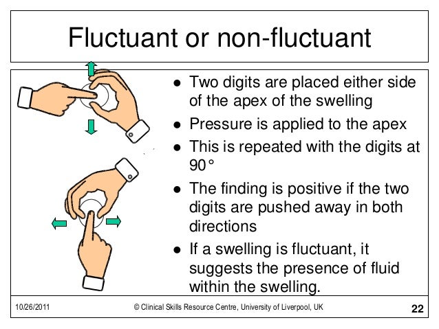 Examination of a Swelling