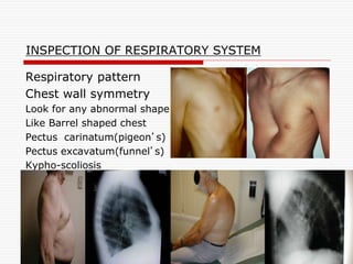 Examination-of-respiratory-system-ppt | PPT