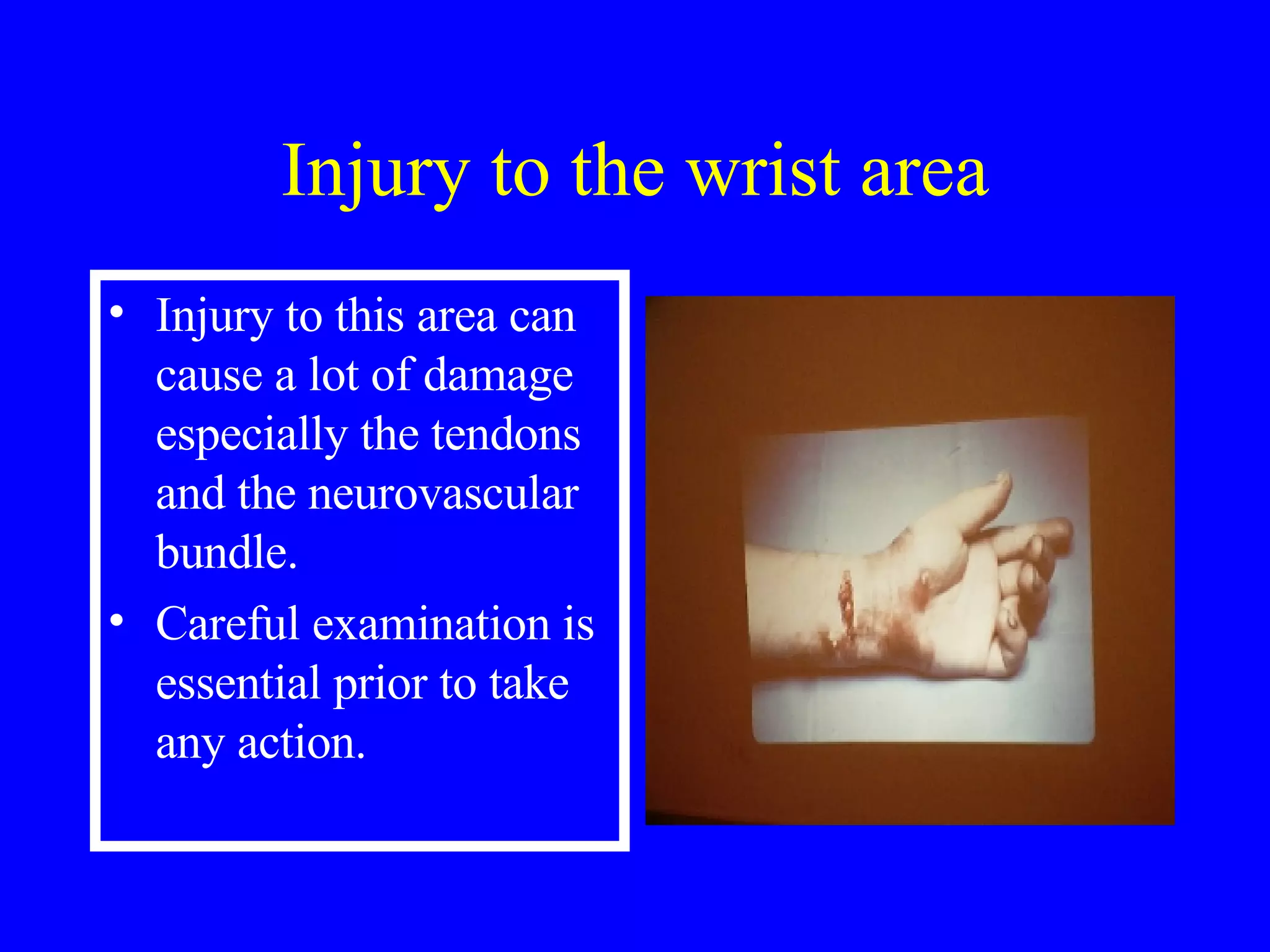 Examination Of The Hand & Wrist | PPT