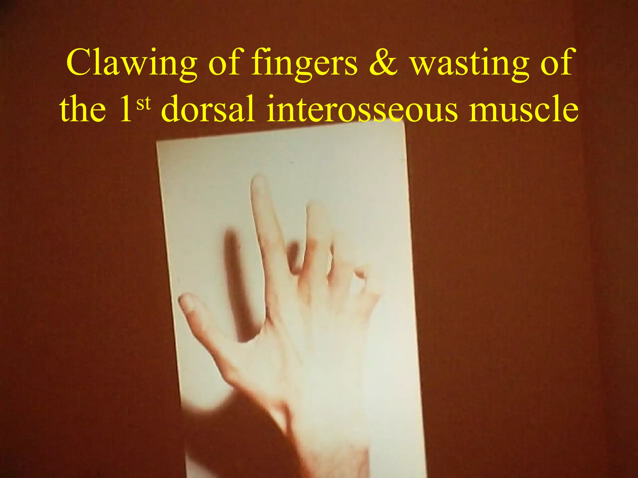 Examination Of The Hand & Wrist | PPT